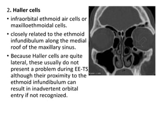 Endoscopic Endonasal Anatomy.pptx