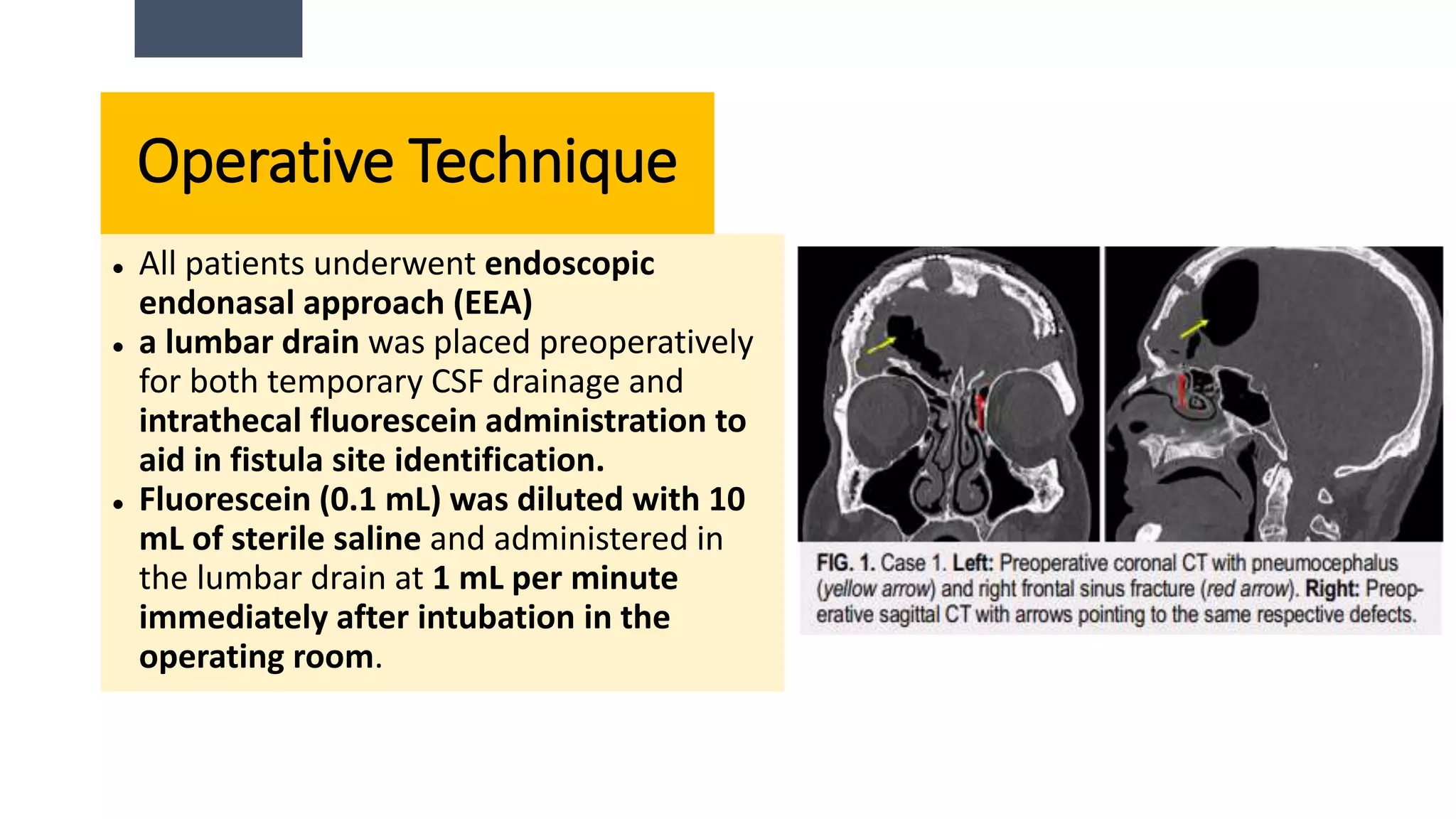 Endoscopic endonasal approaches for reconstruction of traumatic ...