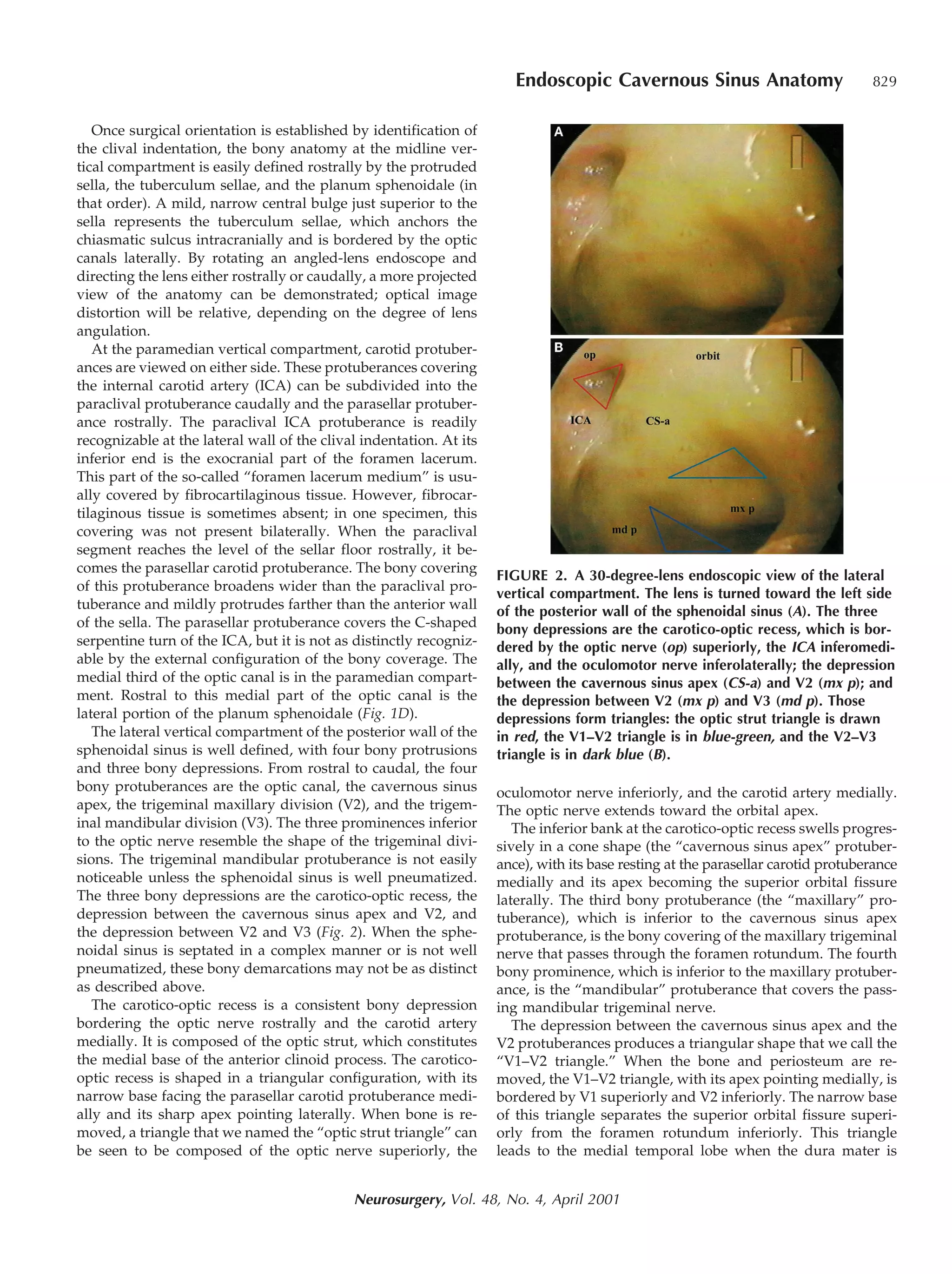 Endoscopic endonasal cavernous sinus surgery: An Anatomic study | PDF