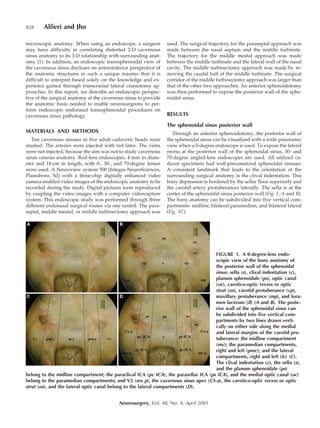 Endoscopic endonasal cavernous sinus surgery: An Anatomic study | PDF