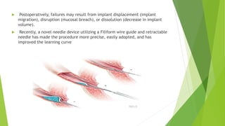Endoscopic injection in VUR | PPT