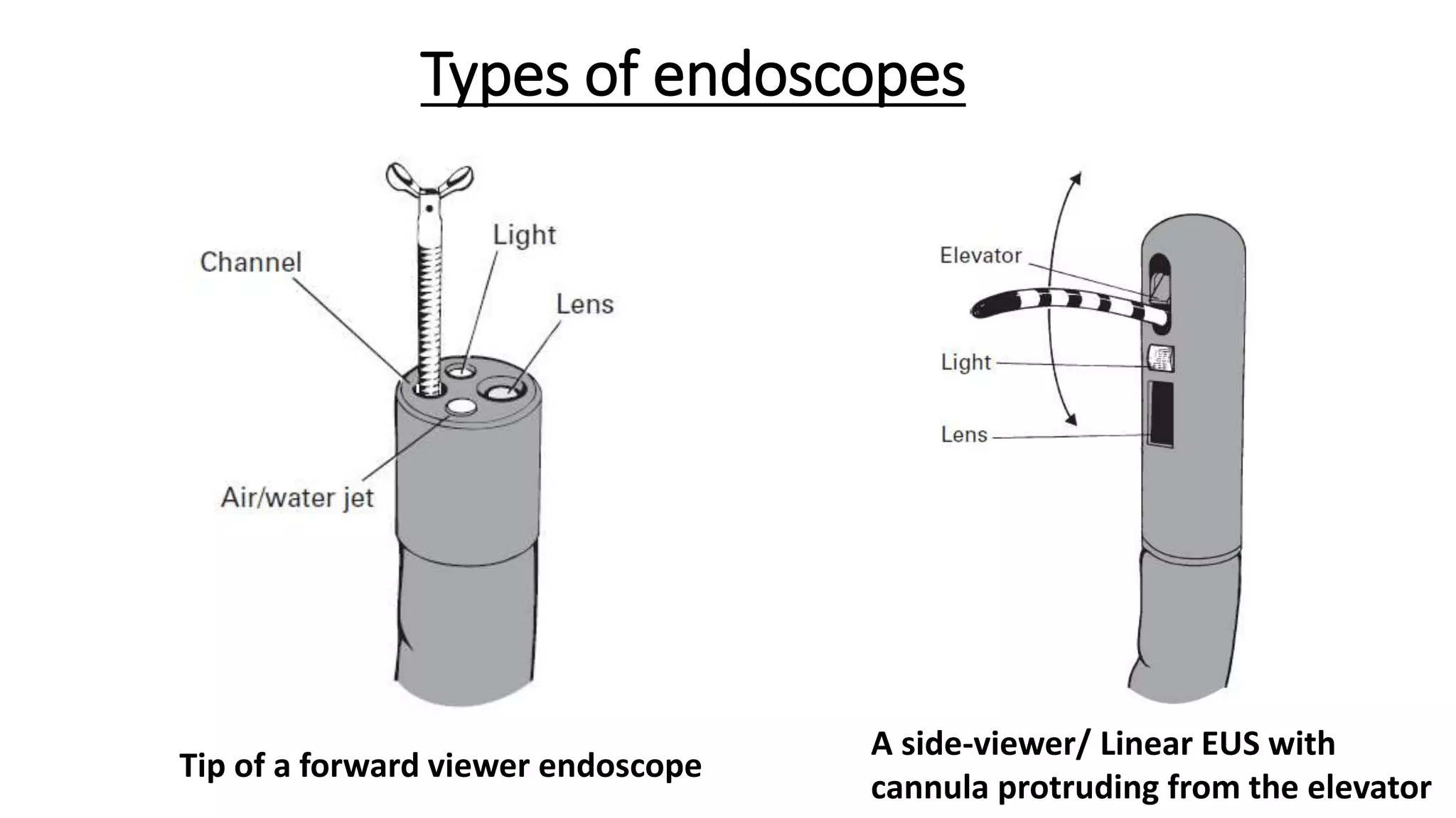 Endoscopic management in pancreatic diseases | PPTX