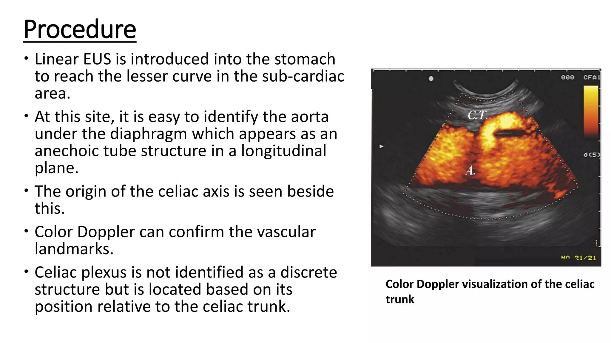 Endoscopic management in pancreatic diseases | PPTX