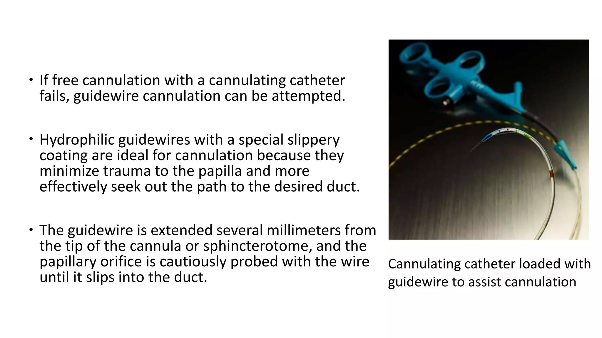 Endoscopic management in pancreatic diseases | PPTX