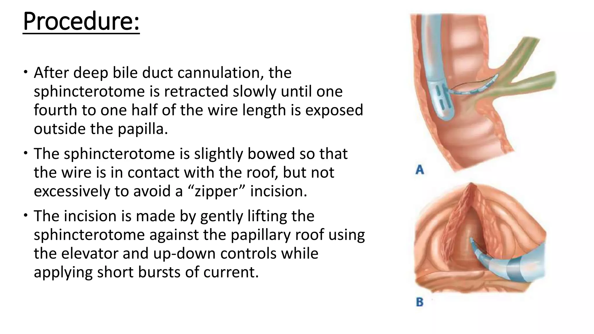 Endoscopic management in pancreatic diseases | PPTX