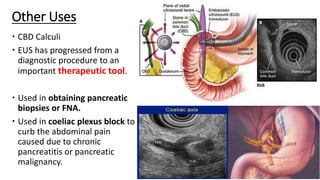 Endoscopic management in pancreatic diseases | PPTX