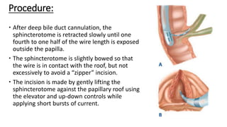 Endoscopic management in pancreatic diseases | PPTX