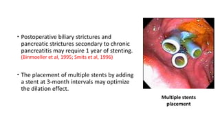 Endoscopic management in pancreatic diseases | PPTX