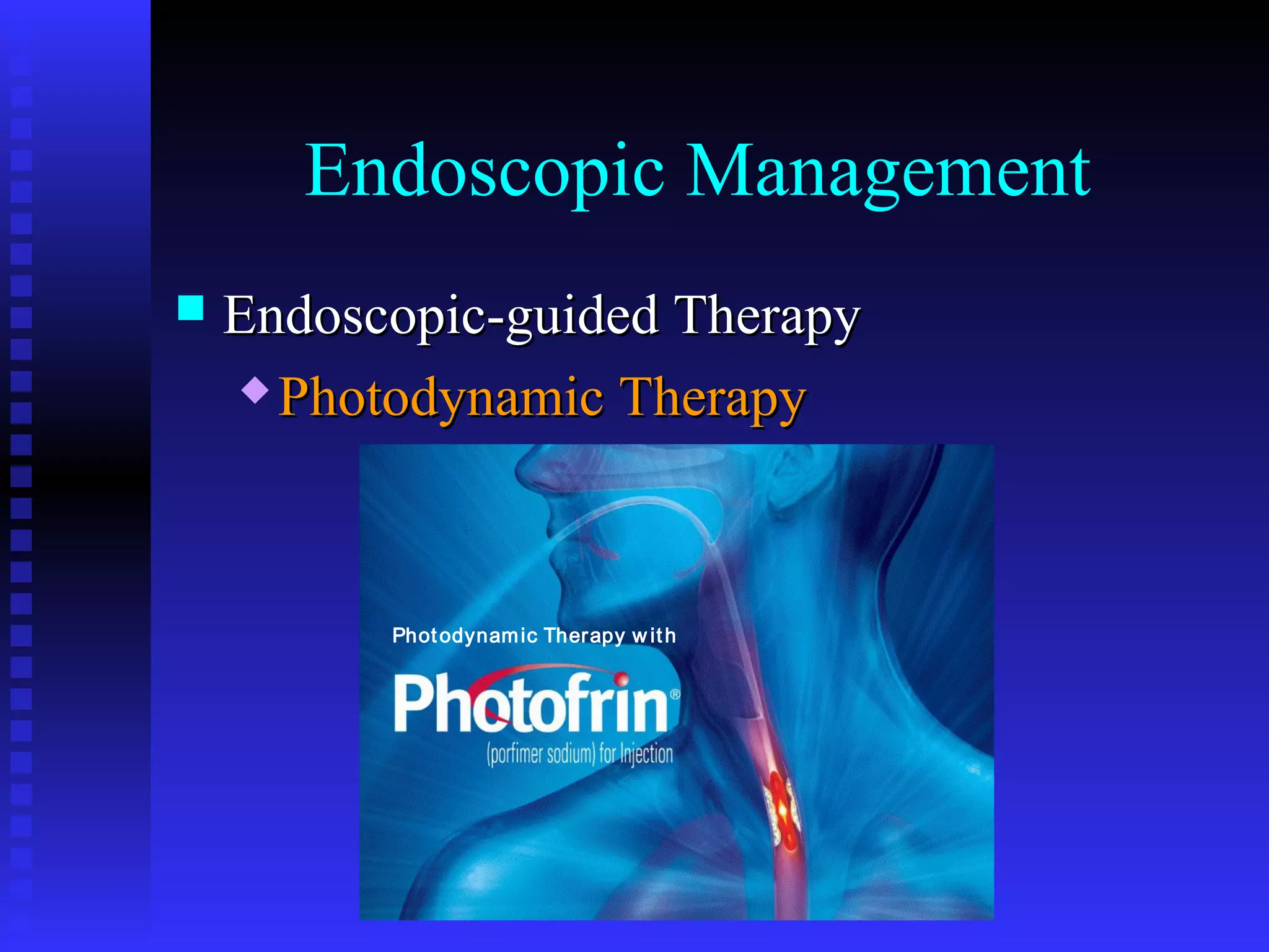 Endoscopic management of bile duct cancers | PPT
