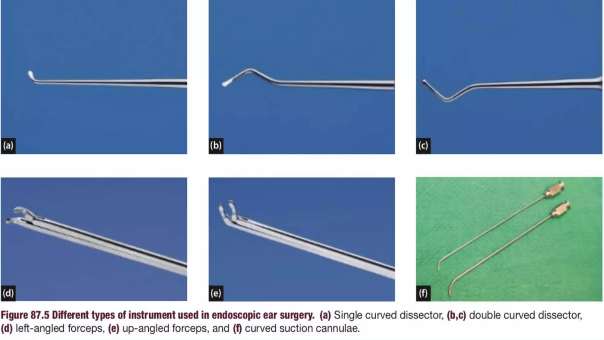 Endoscopic middle ear surgery | PPTX