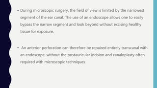 Endoscopic middle ear surgery | PPTX