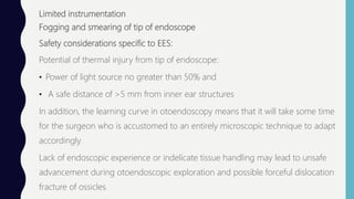 Endoscopic middle ear surgery | PPTX