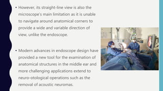 Endoscopic middle ear surgery | PPTX