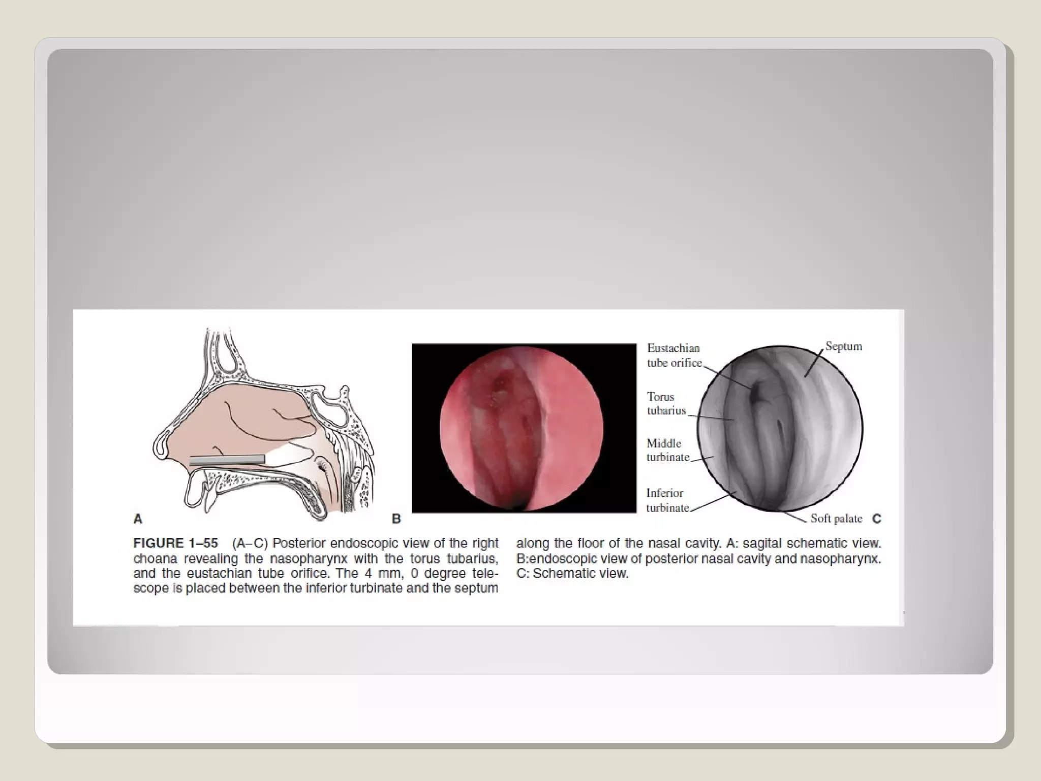 Endoscopic nasal anatomy | PPT