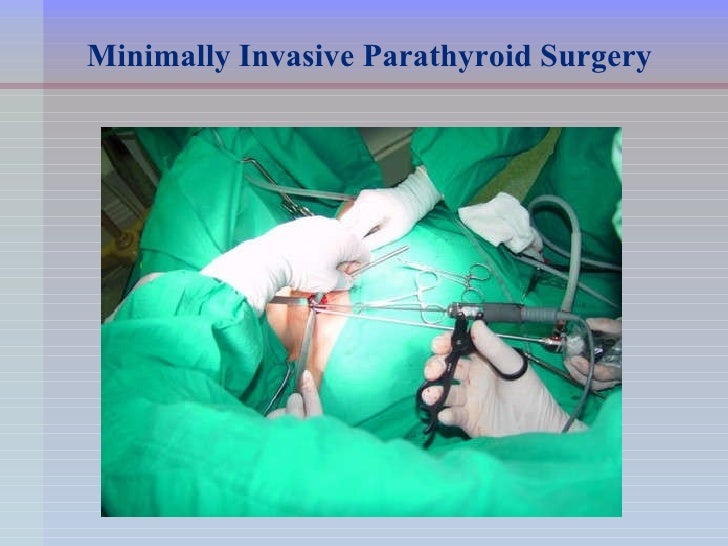 Endoscopic Parathyroid Surgery