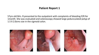 Endoscopic removal of colonic polyps | PPTX