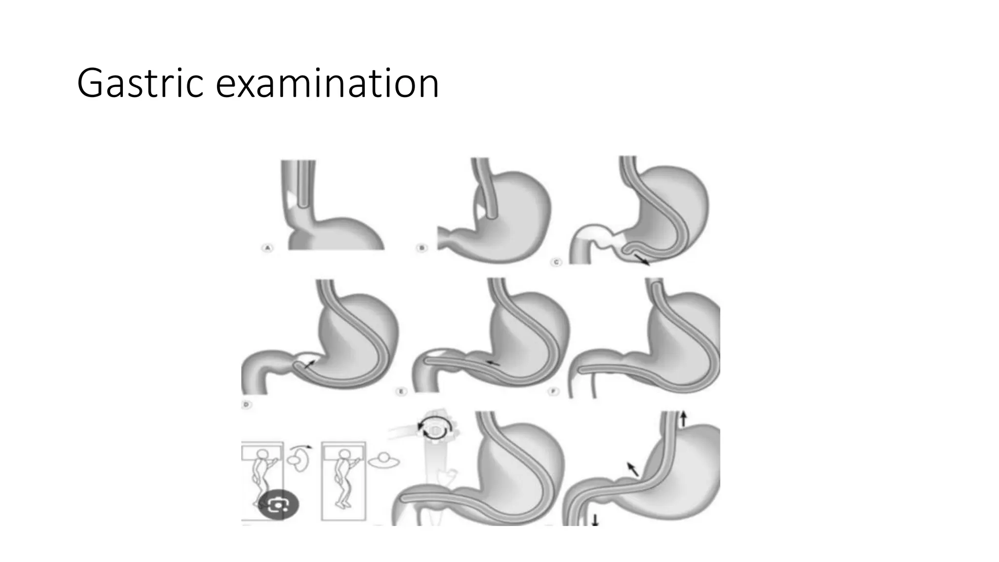 ENDOSCOPIC RETROGRADE CHOLANGIOPACREATOGRAPHY (ERCP).pptx