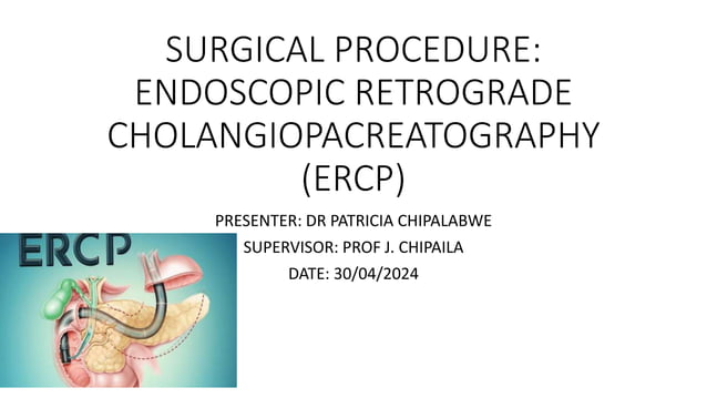 ENDOSCOPIC RETROGRADE CHOLANGIOPACREATOGRAPHY (ERCP).pptx | Digestive Disorders | Diseases and ...
