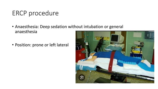 ENDOSCOPIC RETROGRADE CHOLANGIOPACREATOGRAPHY (ERCP).pptx | Digestive ...
