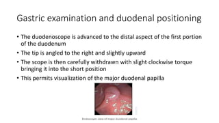 ENDOSCOPIC RETROGRADE CHOLANGIOPACREATOGRAPHY (ERCP).pptx