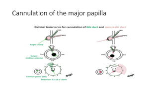 ENDOSCOPIC RETROGRADE CHOLANGIOPACREATOGRAPHY (ERCP).pptx
