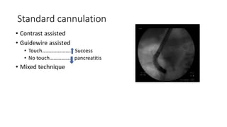 ENDOSCOPIC RETROGRADE CHOLANGIOPACREATOGRAPHY (ERCP).pptx