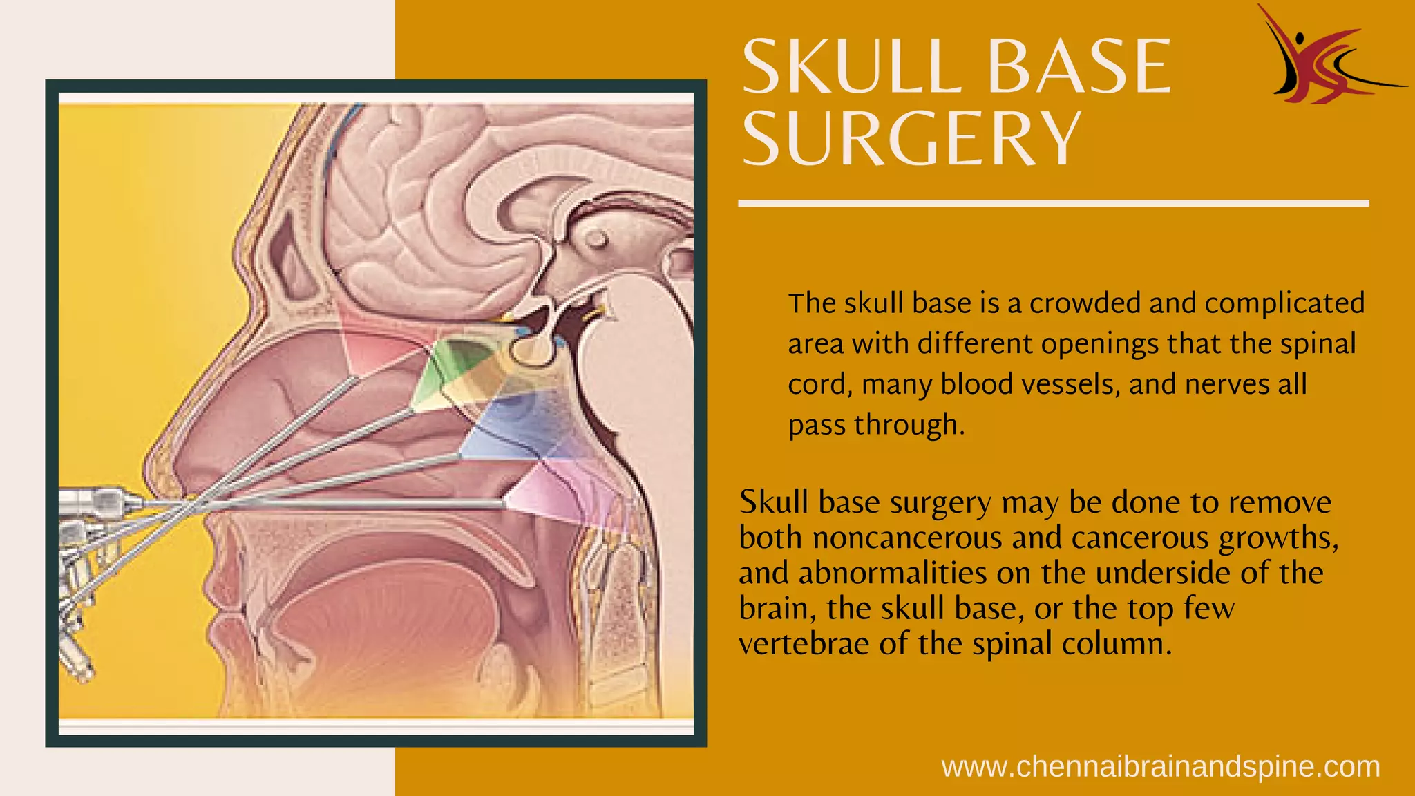 Endoscopic Skull Base Surgery | PDF