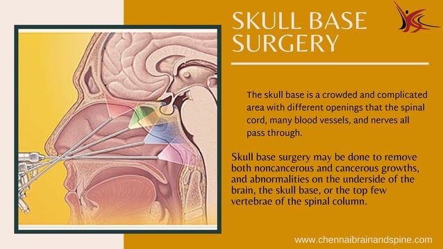 Endoscopic Skull Base Surgery | PDF | Brain and Nervous System ...