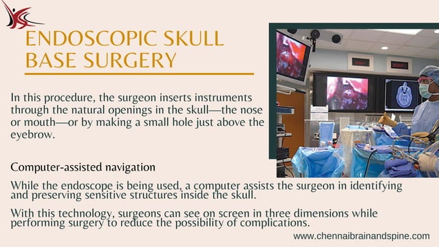 Endoscopic Skull Base Surgery | PDF | Brain and Nervous System ...