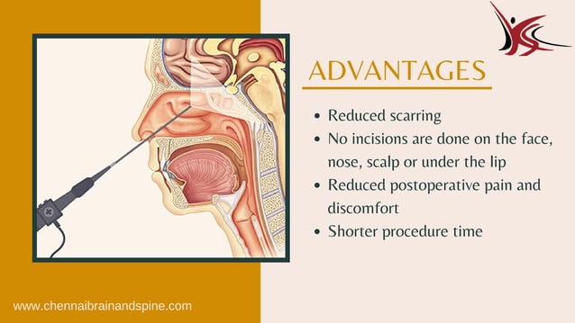 Endoscopic Skull Base Surgery Ppt