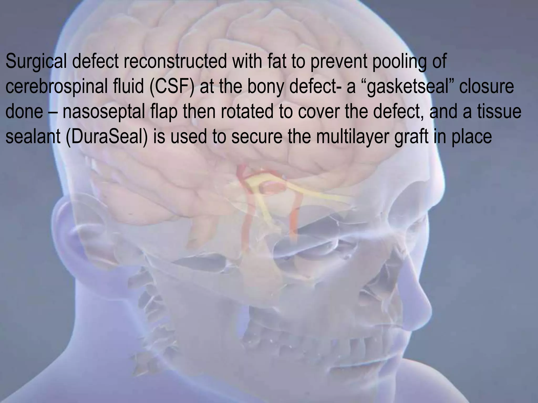 Endoscopic skull base surgery level iii | PPTX
