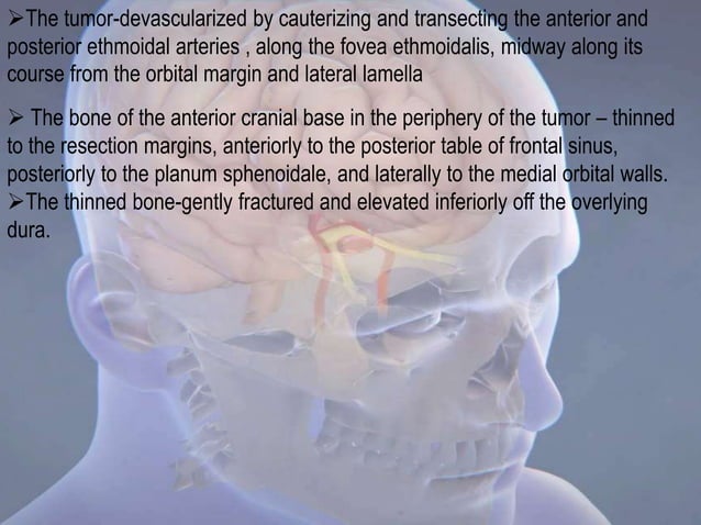 Endoscopic skull base surgery level iii | PPT