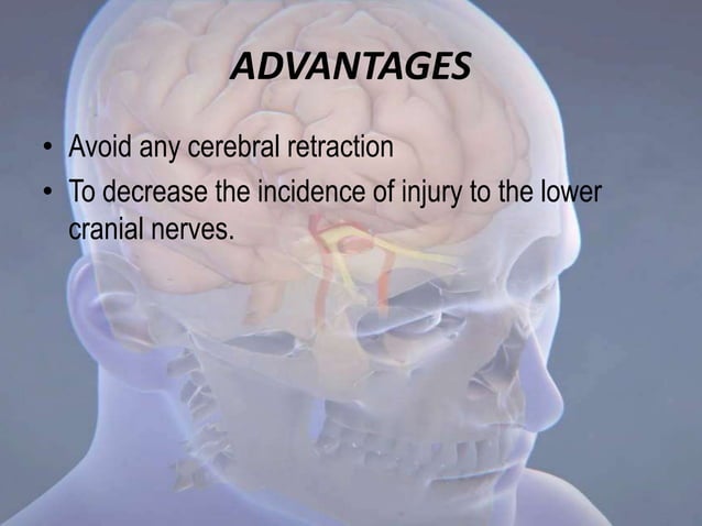 Endoscopic skull base surgery level iii | PPT