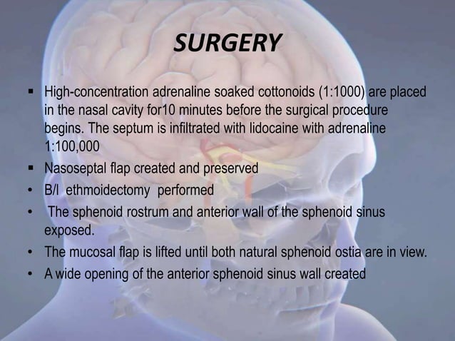 Endoscopic skull base surgery level iii | PPT