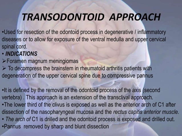 Endoscopic skull base surgery level iii | PPT