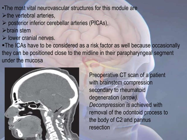 Endoscopic skull base surgery level iii | PPT