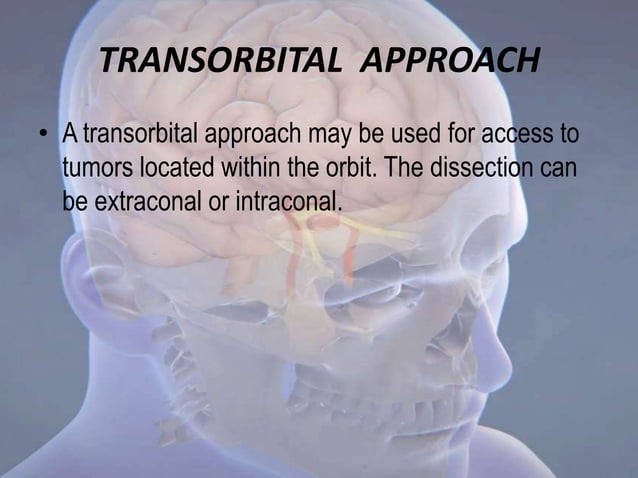 Endoscopic skull base surgery level iii | PPT