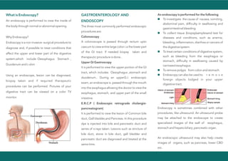Endoscopic sleeve gastroplasty ahmedabad | PDF