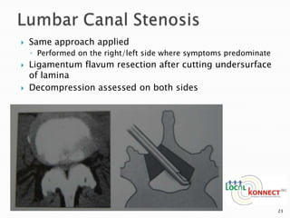Endoscopic spinal surgery | PPTX