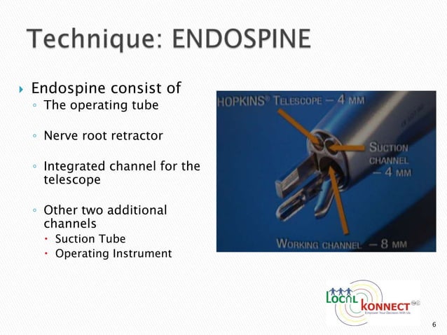 Endoscopic spinal surgery | PPTX | Physical Therapy | Wellness