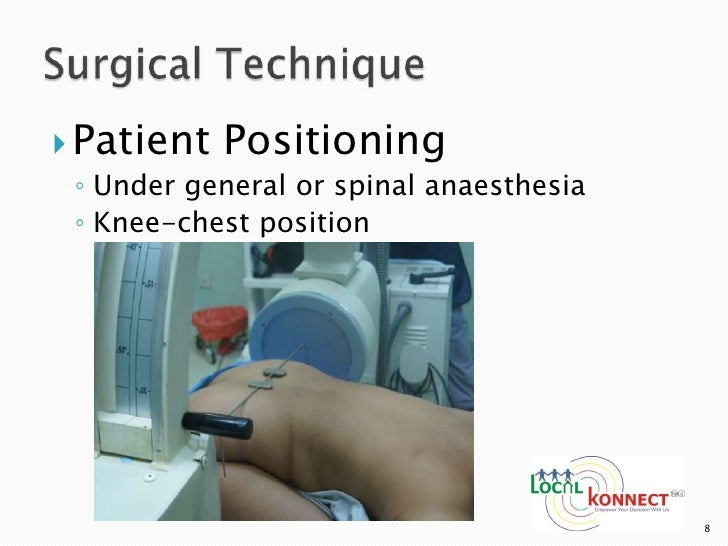 Knee chest position - securedop