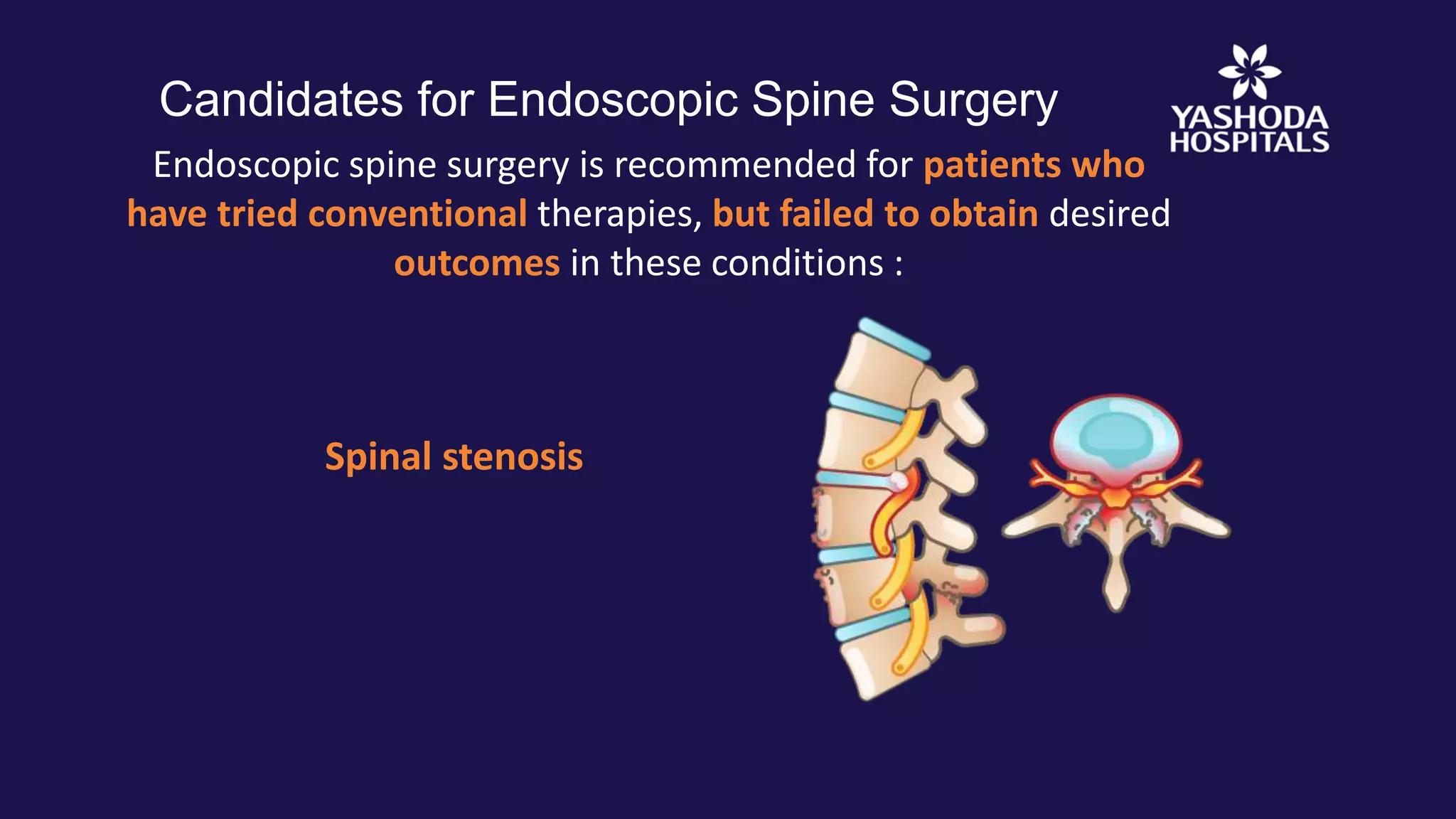 Endoscopic spine surgery | PPTX