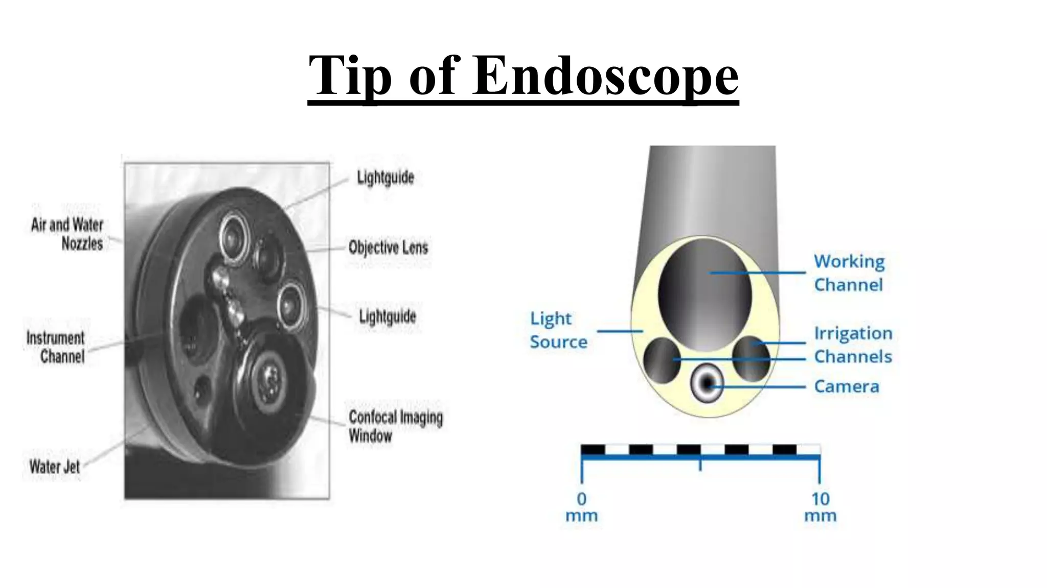 Endoscopic Techniques & Imaging Technologies in Surgical Diseases-Basic ...