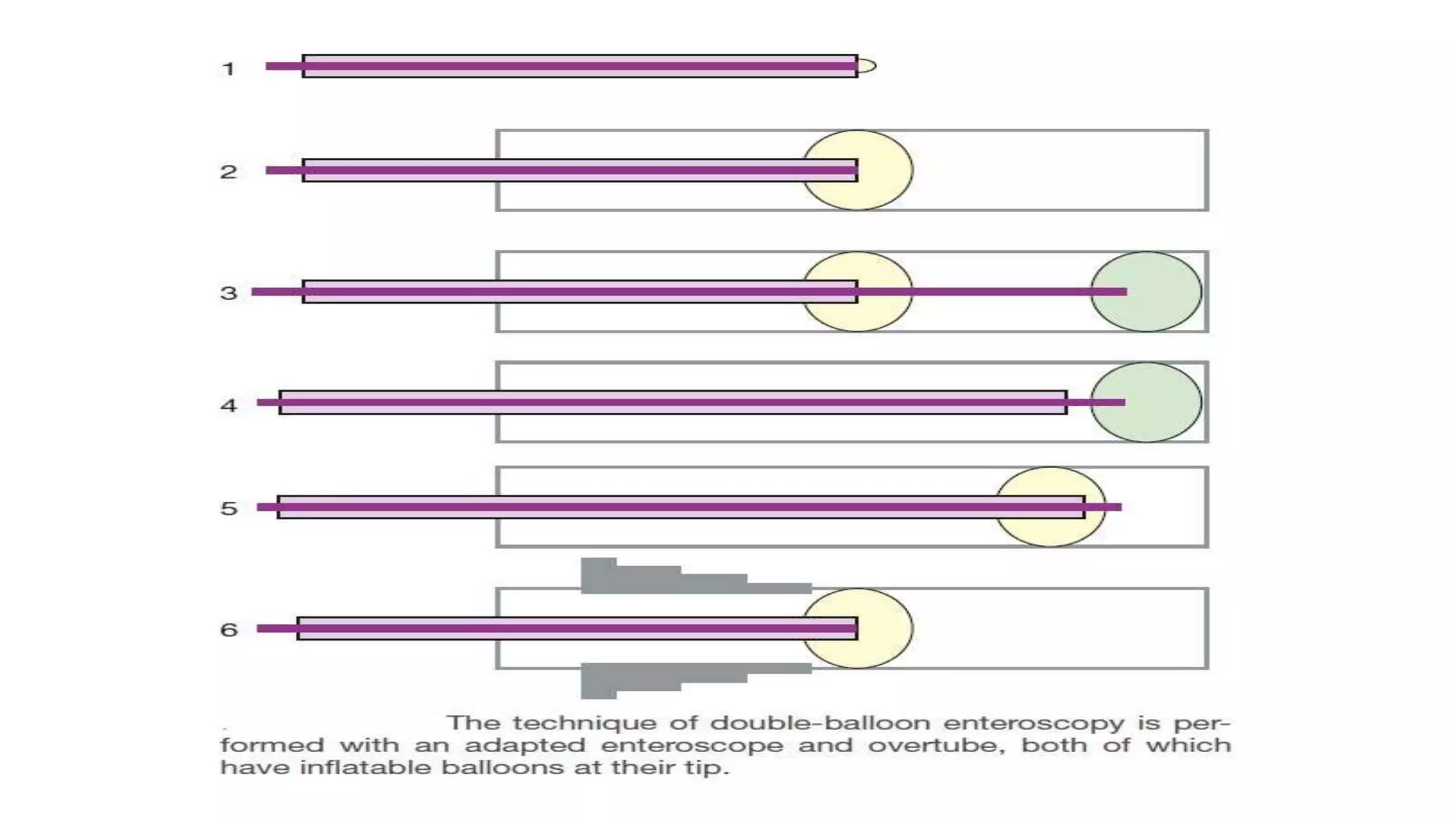 Endoscopic Techniques & Imaging Technologies in Surgical Diseases-Basic ...