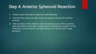 Endoscopic Transnasal transsphenoid pituitary Surgery (Erbil).pptx