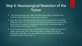 Endoscopic Transnasal transsphenoid pituitary Surgery (Erbil).pptx