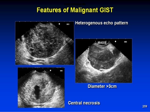 Endoscopic ultrasonographi