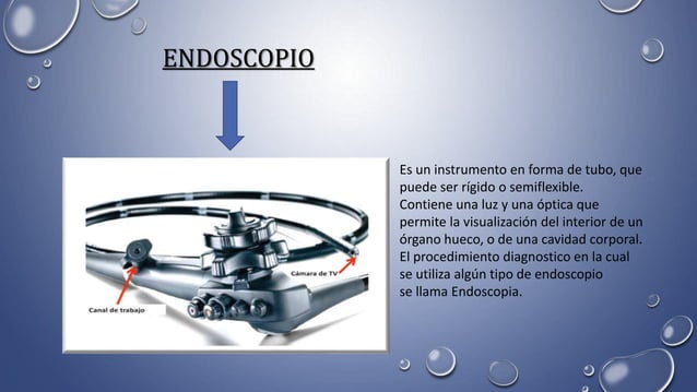 Endoscopio flexible | PPT