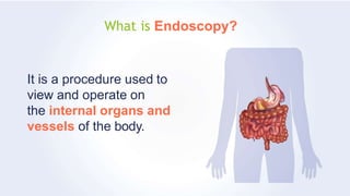 Endoscopy-1.pptx