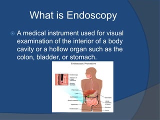 Endoscopy | PPTX